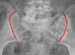 Becken / Hüfte Arzt | OrthoRad